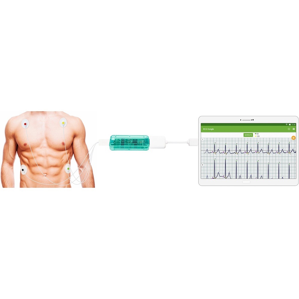 Купить Кардиофлешка Nordavind ECG Dongle в Москве